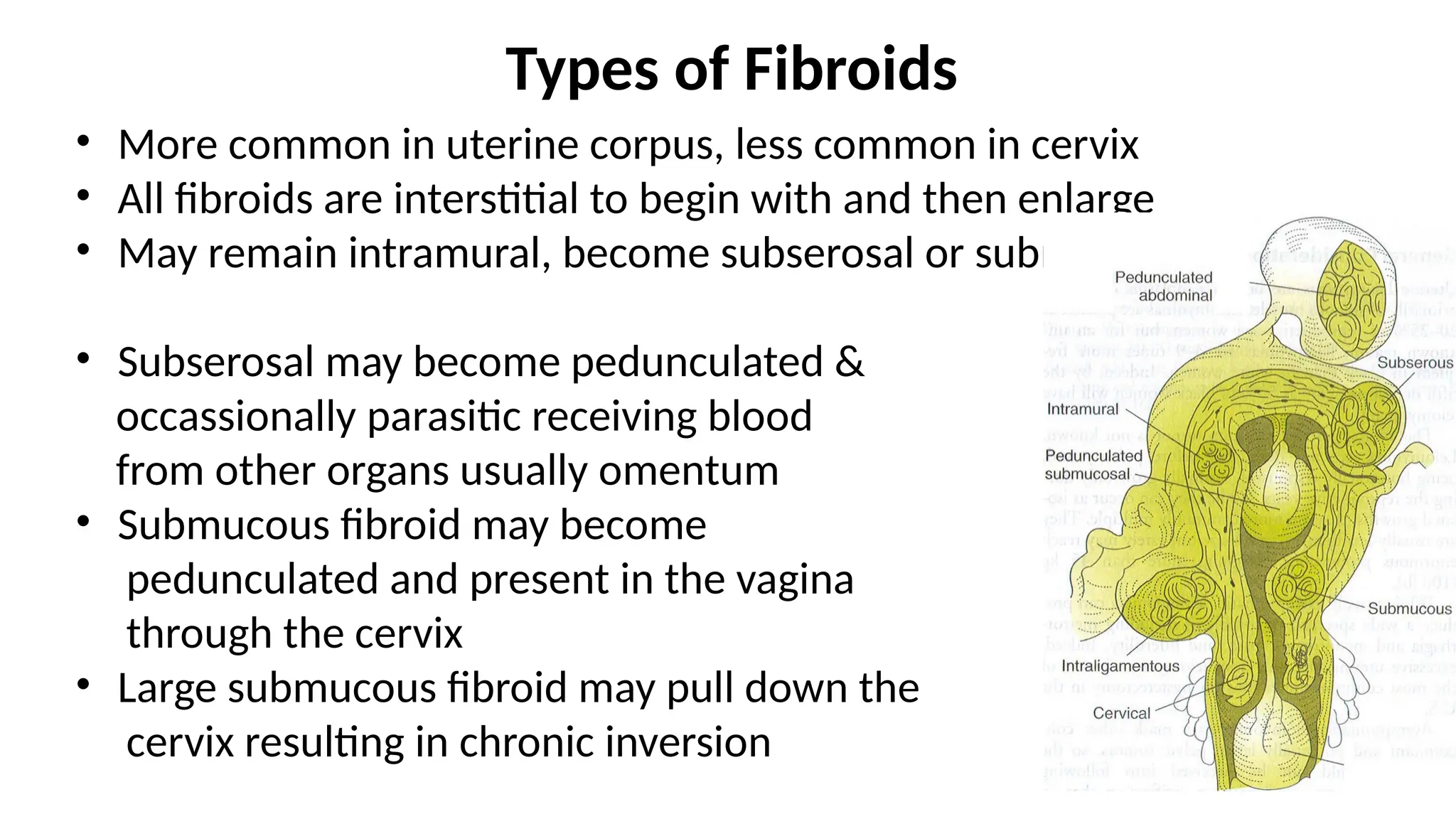 Uterine Fibroid Presentation for ONGpptx | PPTX
