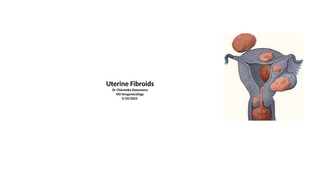 Uterine Fibroid Presentation for ONGpptx | PPT