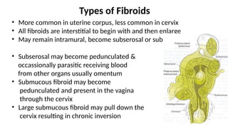 Uterine Fibroid Presentation for ONGpptx | PPTX