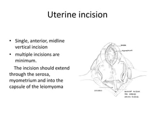 Uterine fibroids | PPT