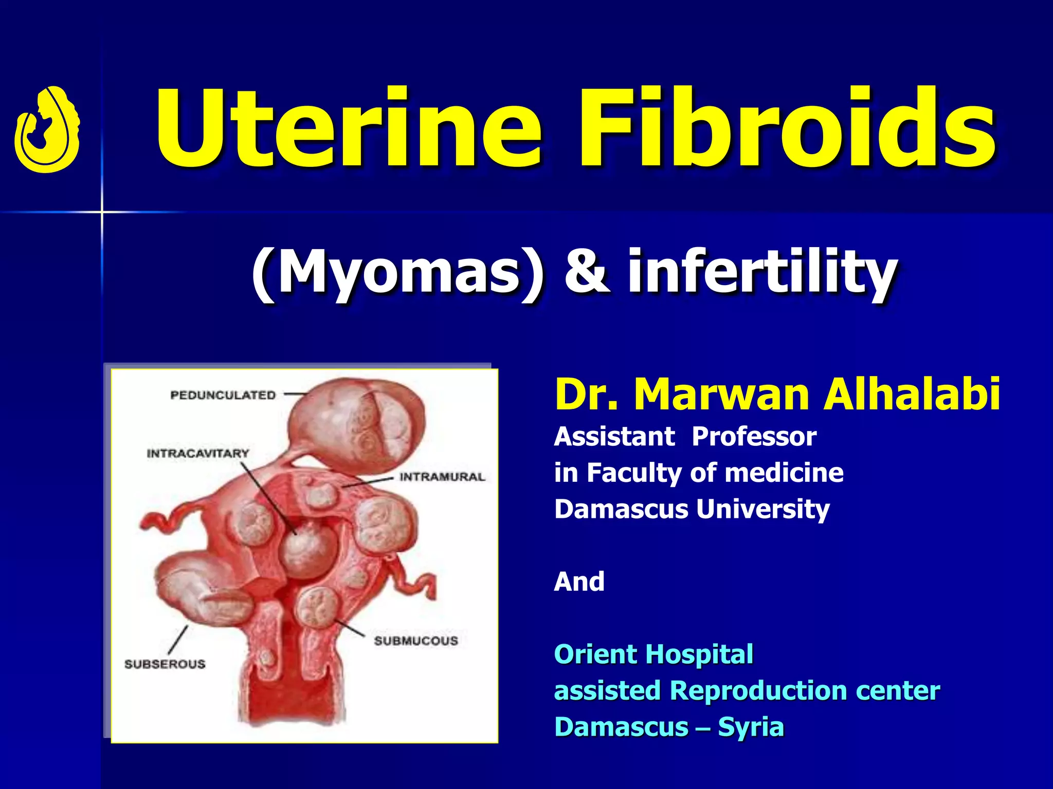 Uterine fibroids ( Myomas ) and infertility | PDF