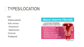 Uterine fibroids.pptx