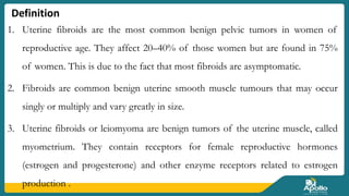 uterine fibroids.pptx