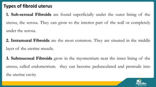 uterine fibroids.pptx