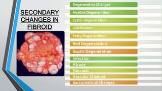 UTERINE FIBROIDS.pptx