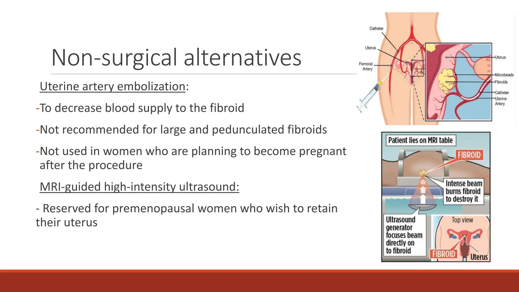 uterine fibroids. bleeding. myoma pptxjj | PPT