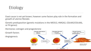 uterine fibroids. bleeding. myoma pptxjj | PPT