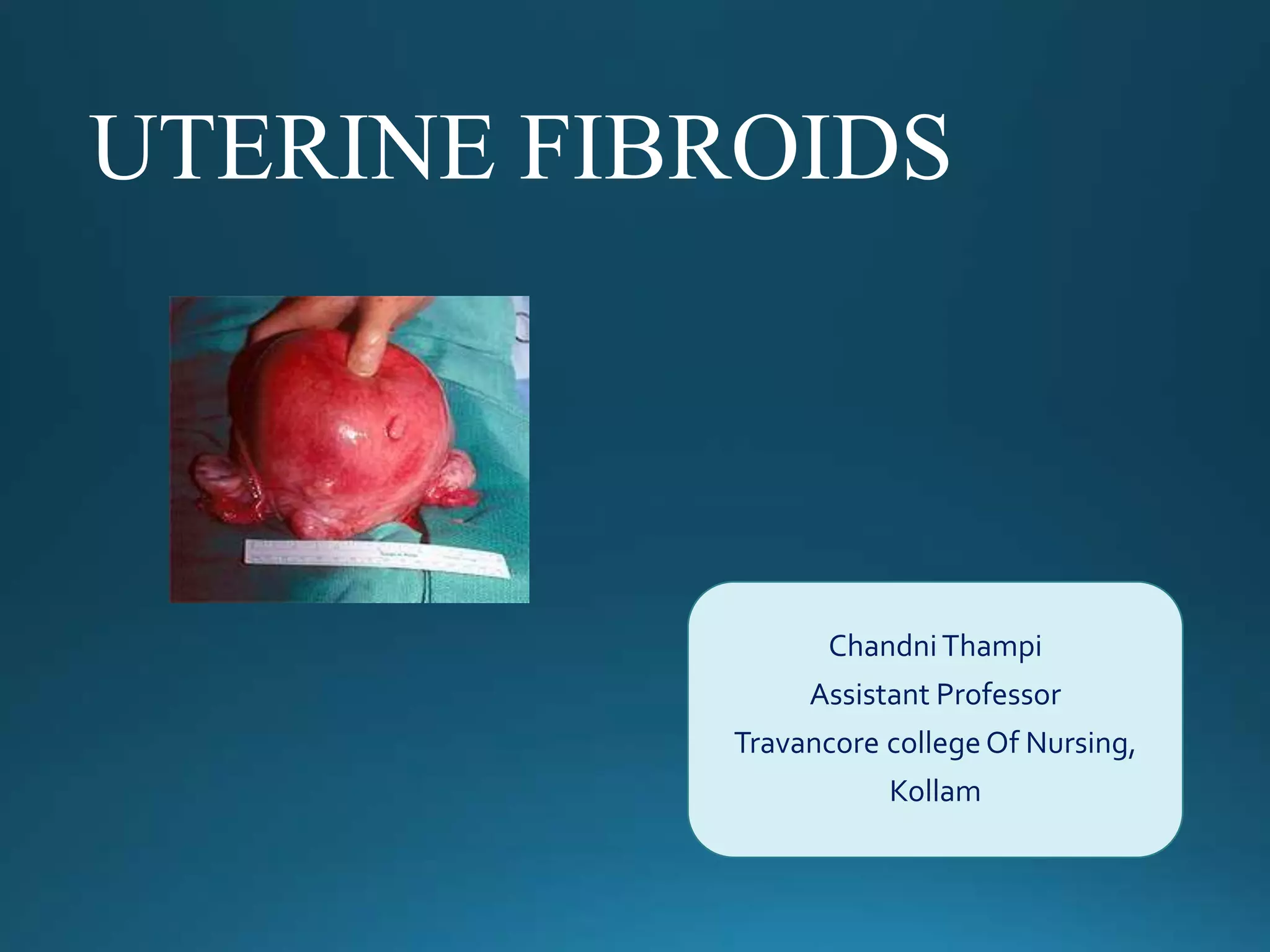 Uterinefibroids chandni | PPTX