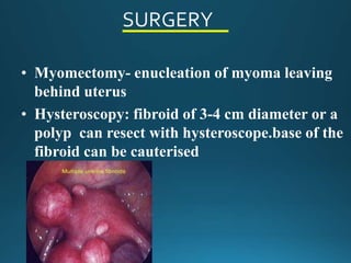 Uterinefibroids chandni | PPTX
