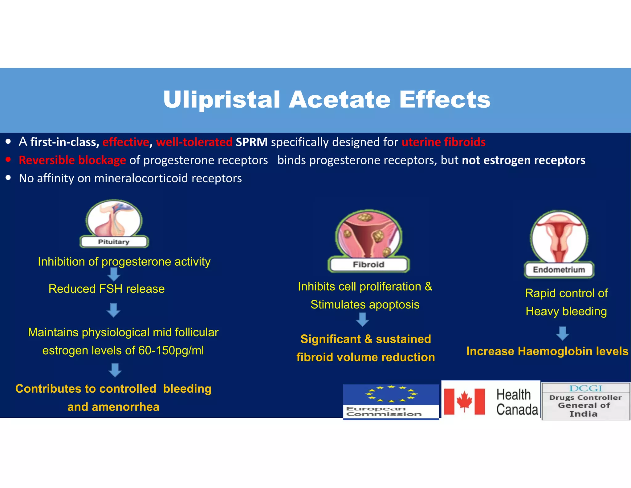 Uterine Fibroids - when to say NO to knives.pdf