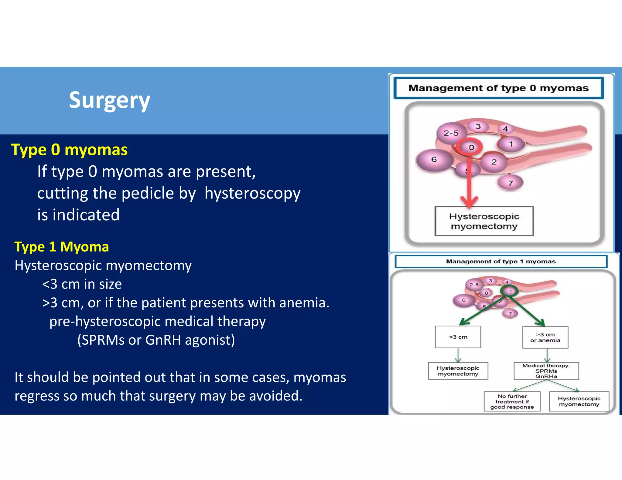 Uterine Fibroids - when to say NO to knives.pdf