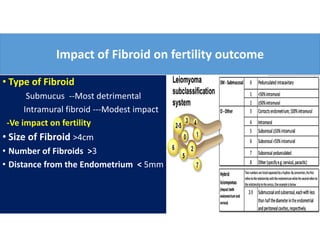 Uterine Fibroids - when to say NO to knives.pdf