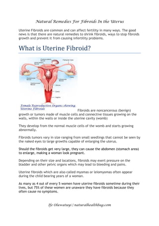 How to Shrink Fibroids Naturally | PDF