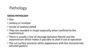 Uterine fibroids by oouth unit b medical students o&g | PPTX