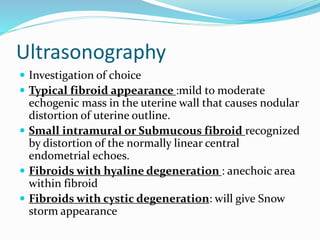 Uterine fibroids by Dr sehrish fatima | PPTX