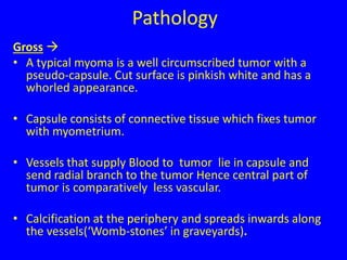Uterine fibroids | PPTX
