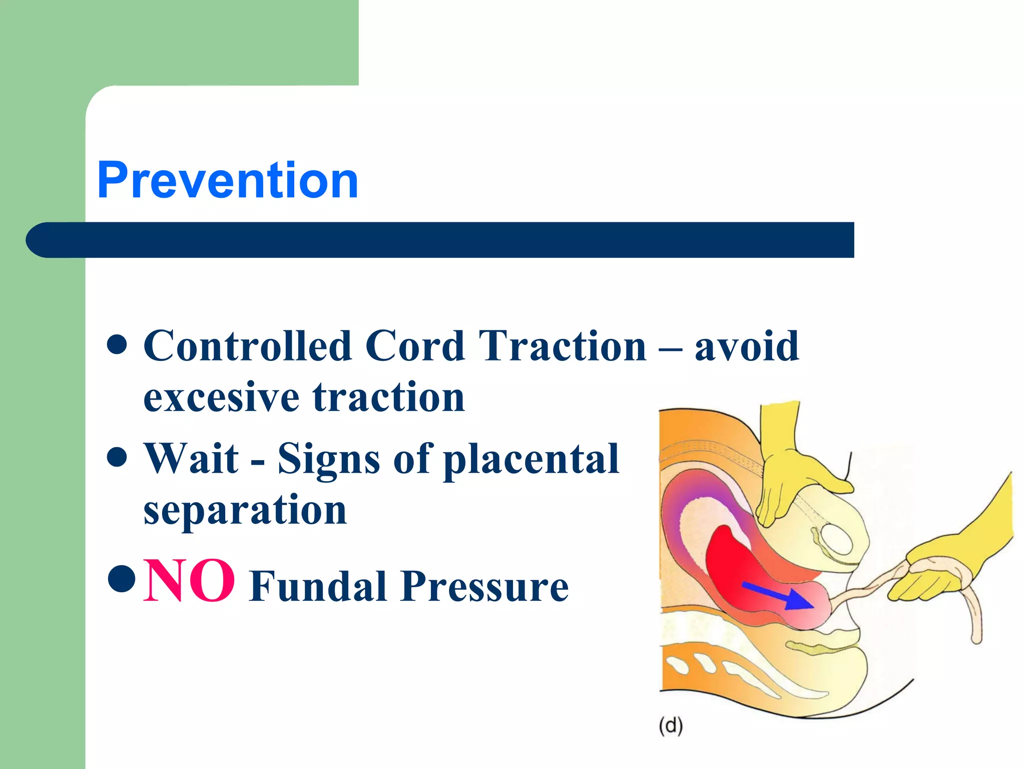Uterine Inversion | PPT