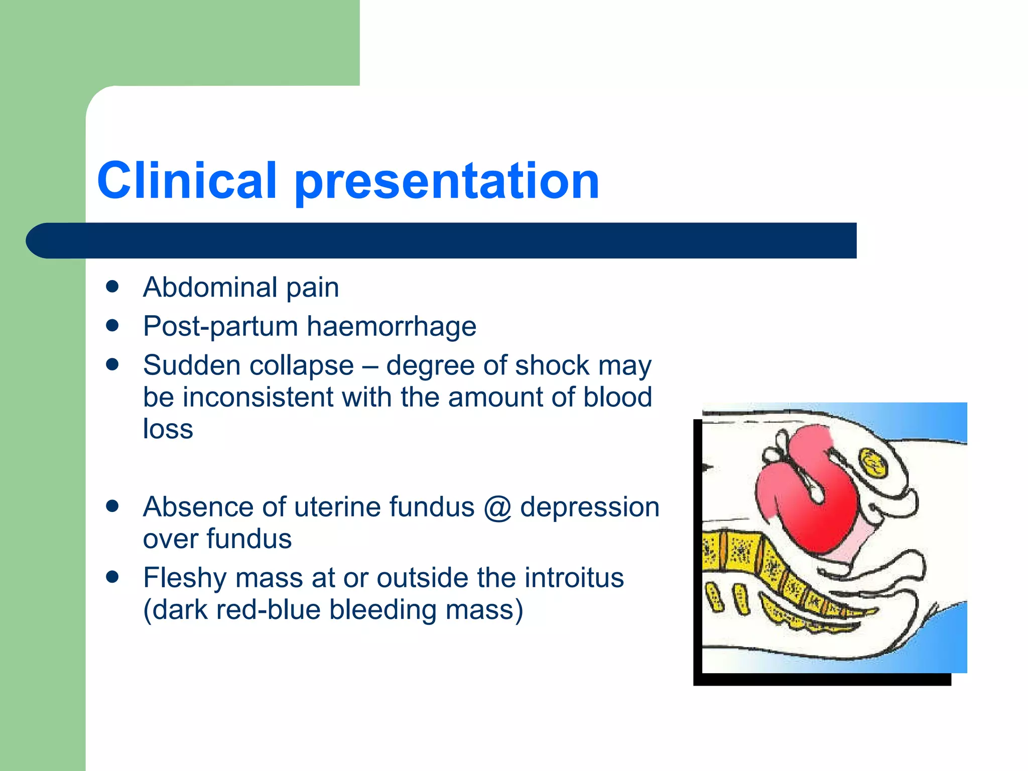 Uterine Inversion | PPT