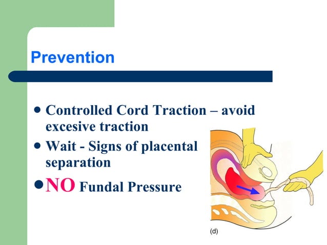 Uterine Inversion | PPT | Pregnancy | Reproductive Health