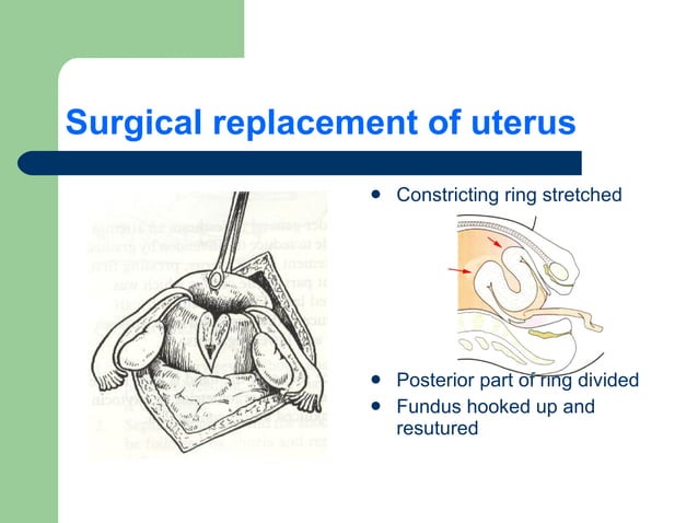 Uterine Inversion | PPT | Pregnancy | Reproductive Health