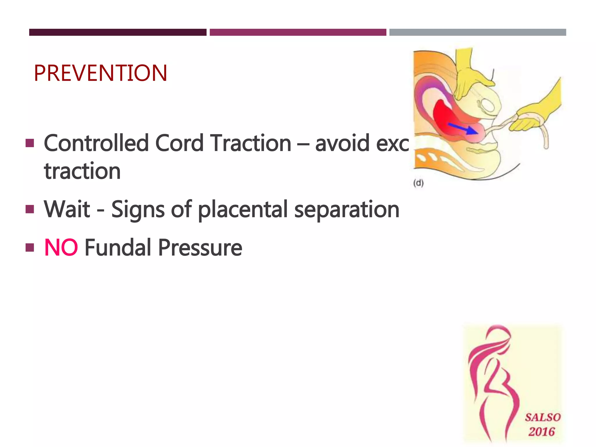 Uterine inversion 2016 | PPTX