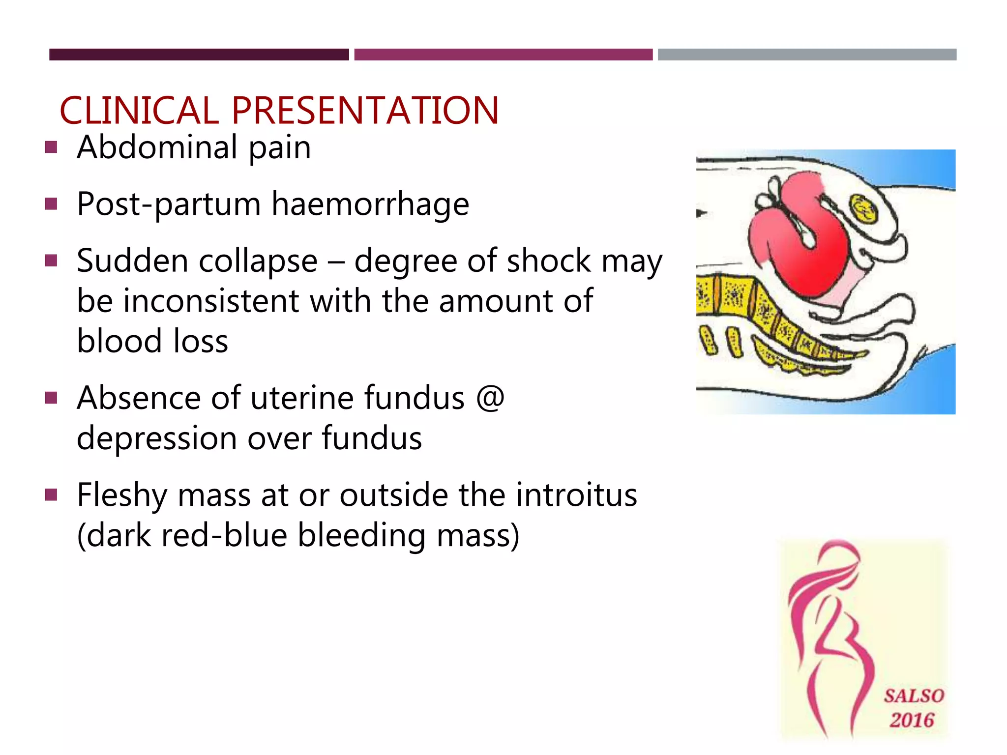 Uterine inversion 2016 | PPTX