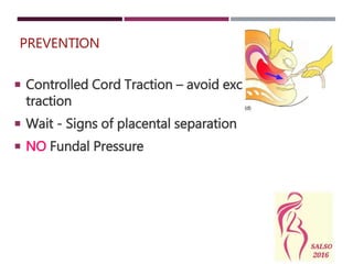 Uterine inversion 2016 | PPTX