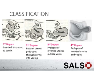 Inversion Of The Uterus