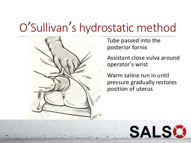 Uterine Inversion 2018