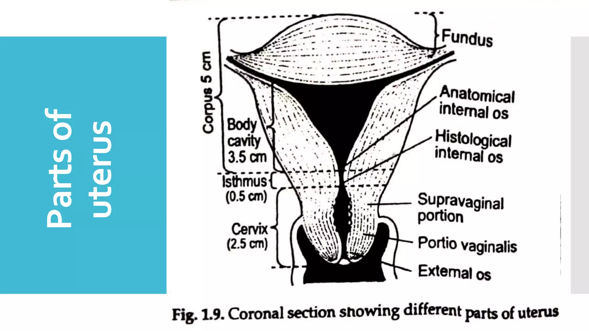 Uterine malformations | PPTX