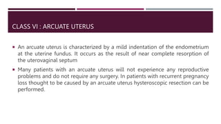 Uterine Malformations.pptx