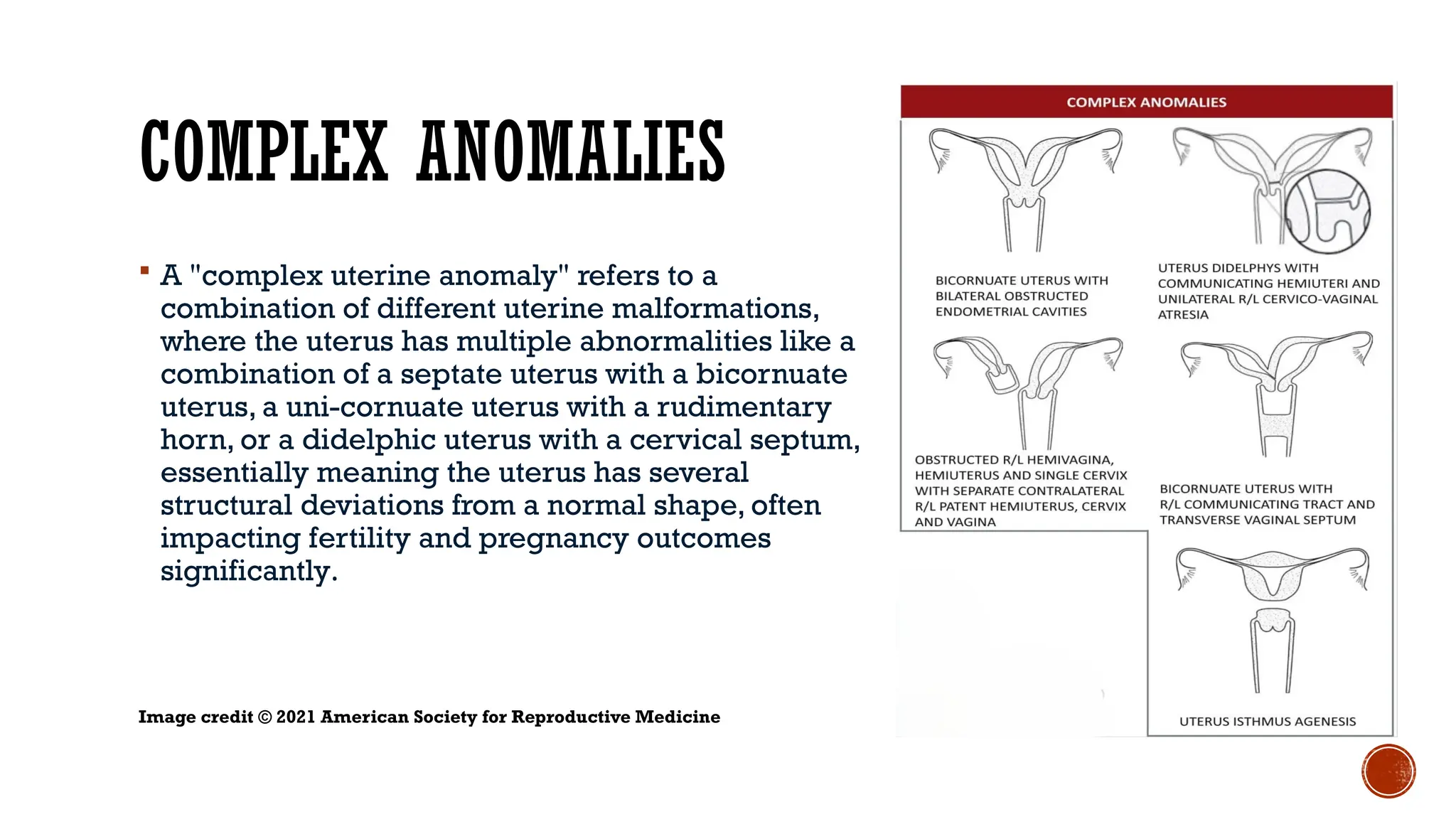 UTERINE MALFORMATIONS IN GYNECOLOGICAL NURSING ( MIDWIFERY).pptx
