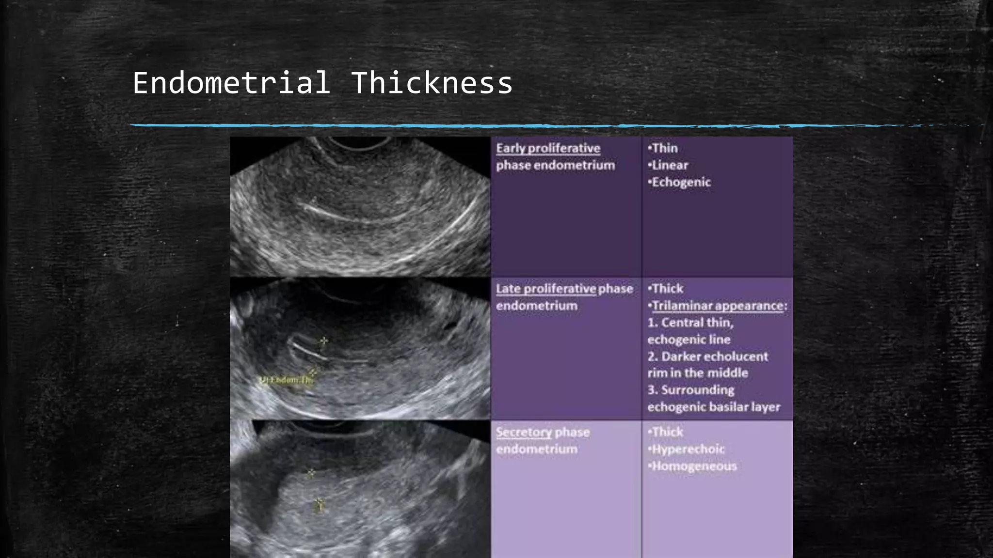 Uterine Myoma, Endometriosis, Endometrial Ca and.pptx