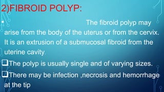 Uterine polyps | PPTX
