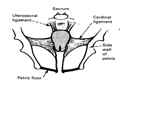 Uterineprolapse 130223183535 Phpapp02pdf