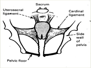 Uterine prolapse | PPTX