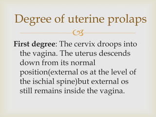 Uterine prolapse | PPTX