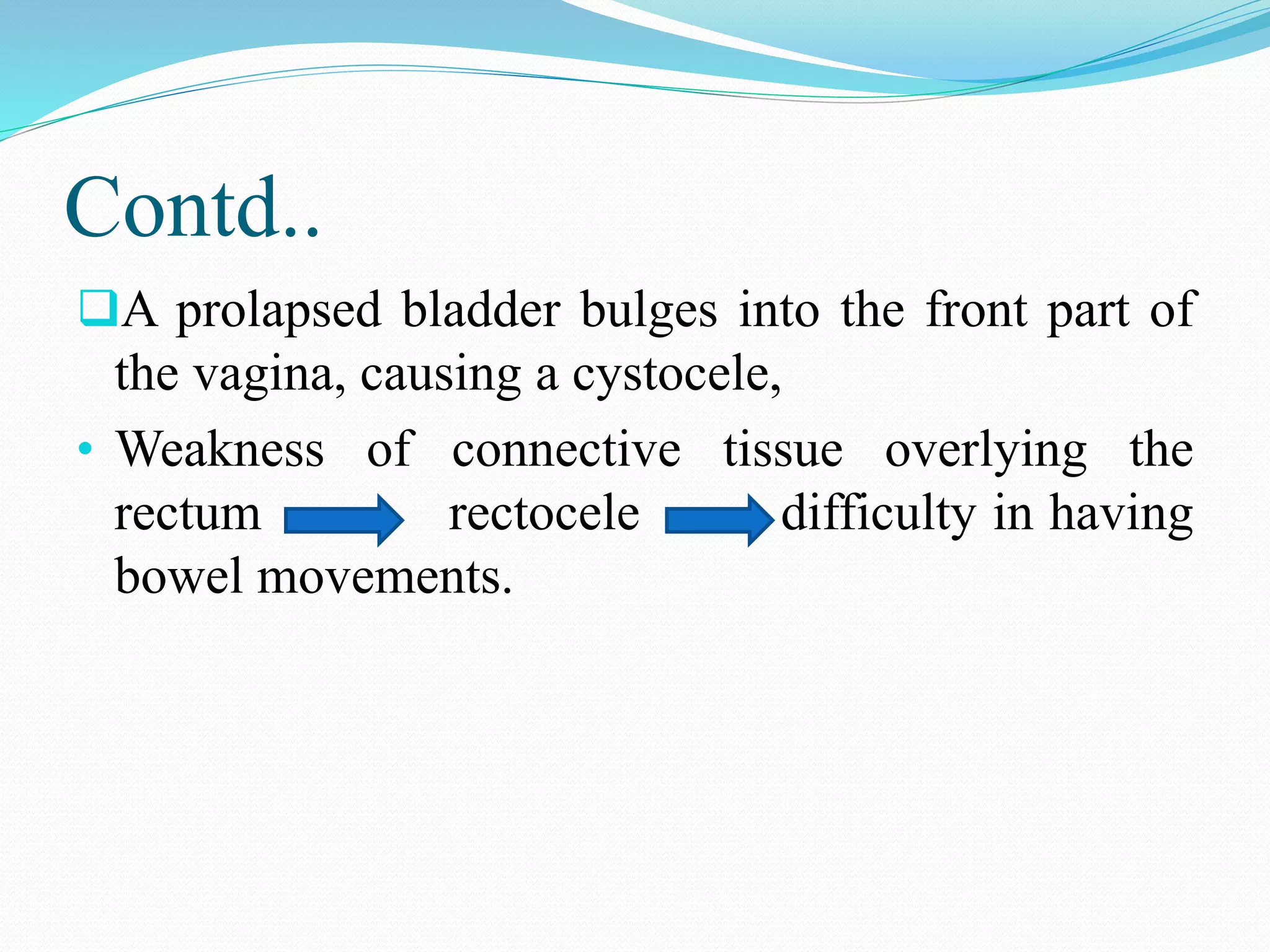 Uterine prolapse | PPTX