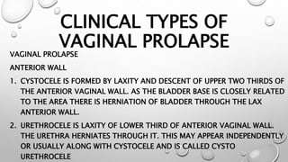 Uterine prolapse | PPTX