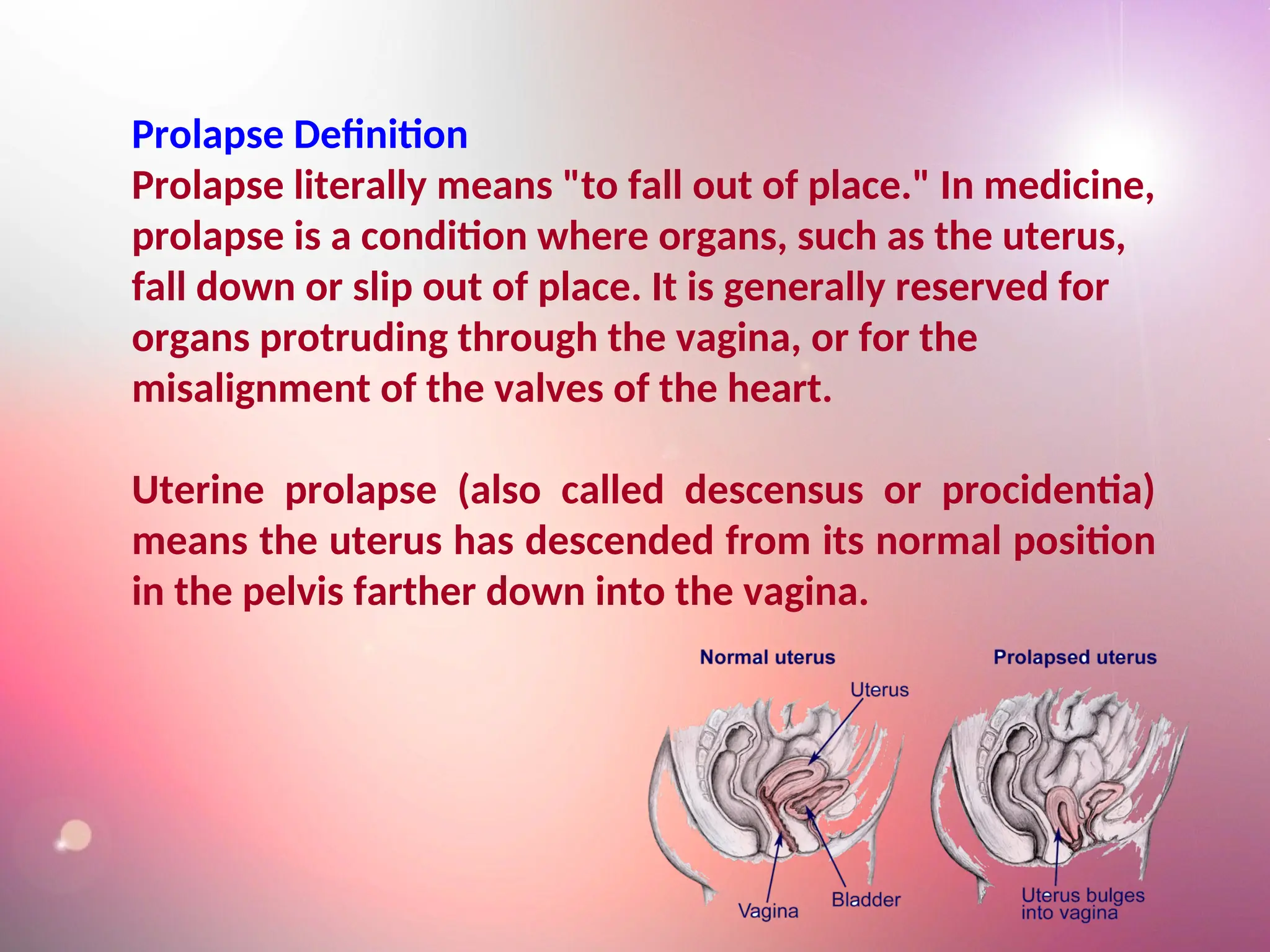 uterine prolapse in displacement final.ppt | Pregnancy | Reproductive ...