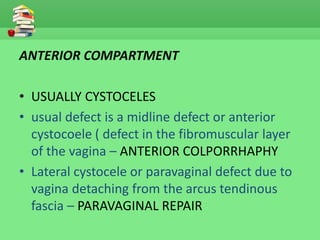 Uterine prolapse management | PPTX