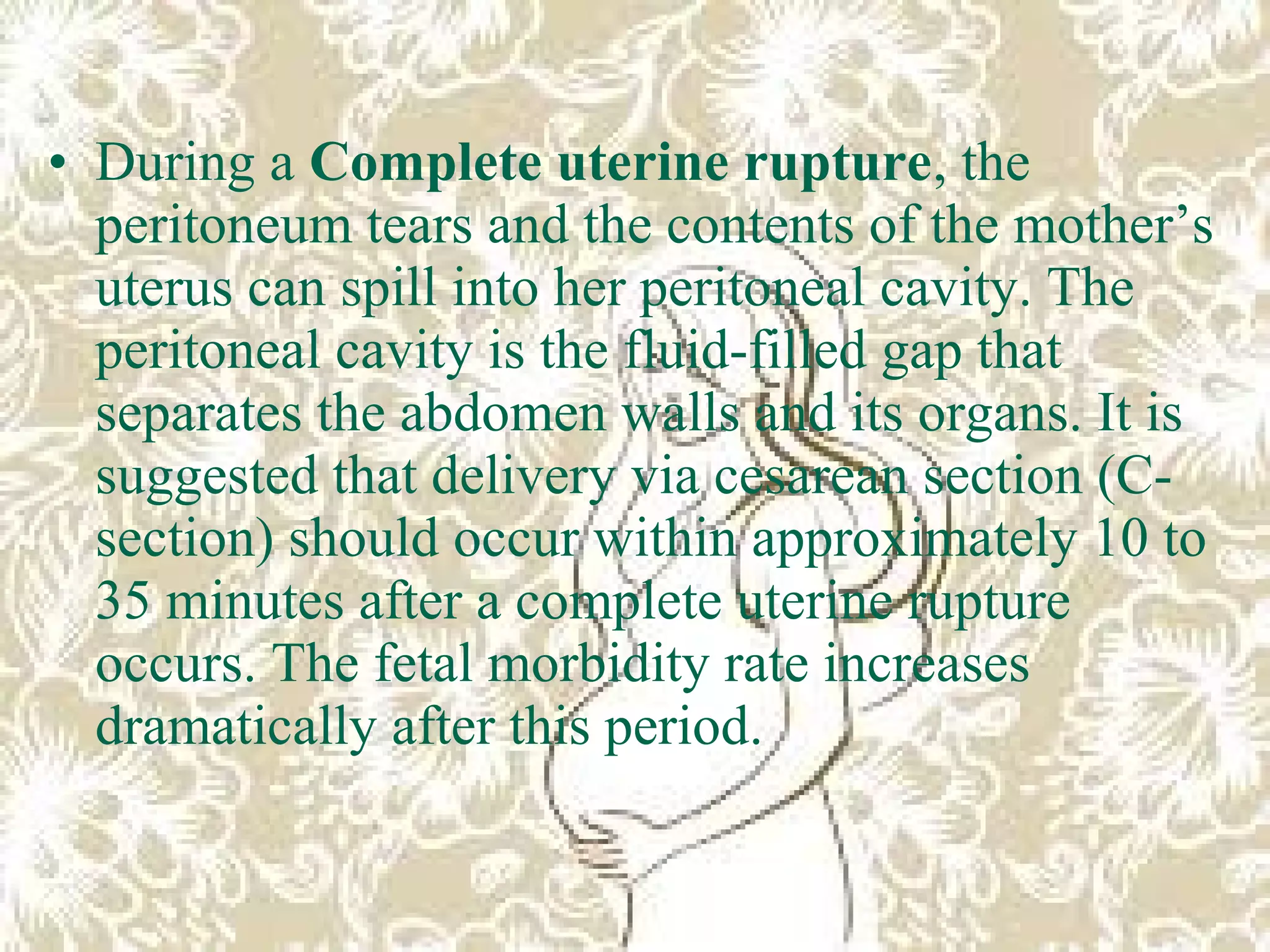 Uterine rupture | PPT