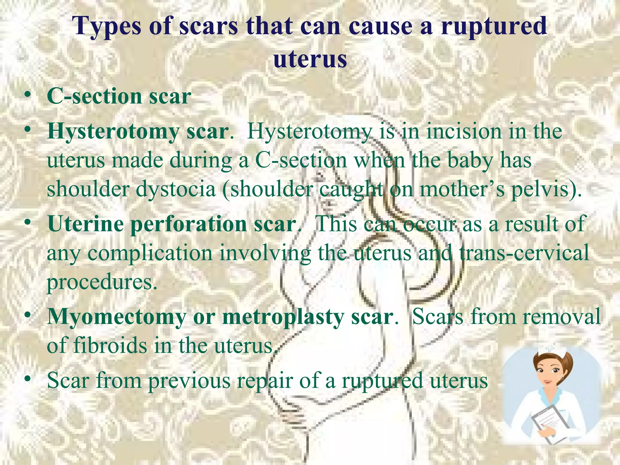 Uterine rupture | PPT