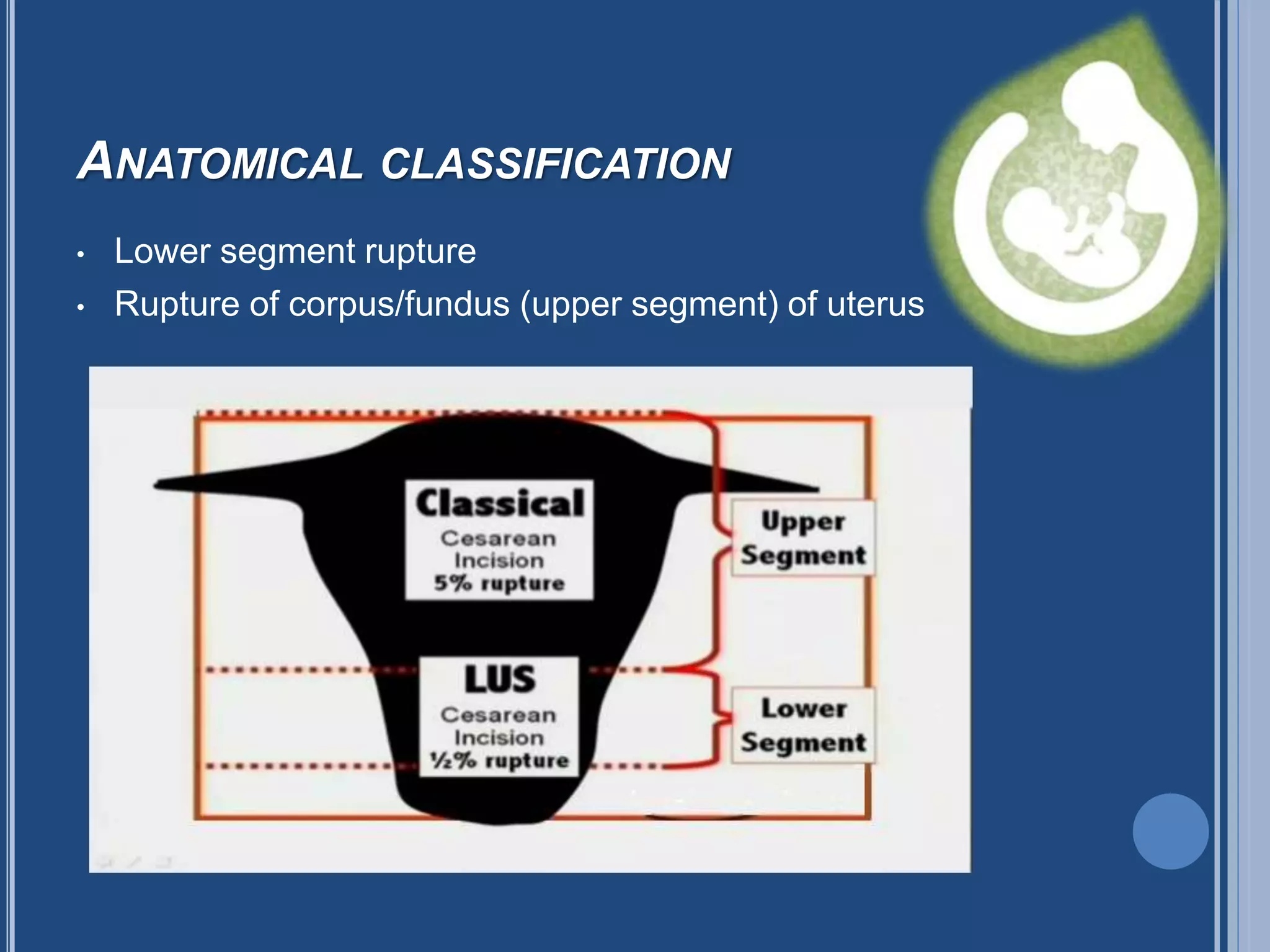 Uterine rupture - All you need to know. | PPTX