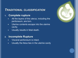 Uterine rupture - All you need to know. | PPTX