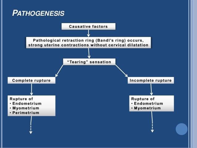 Uterine rupture - All you need to know.