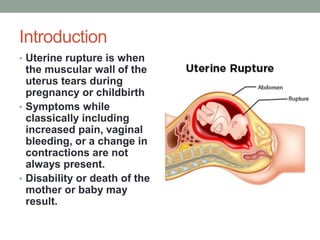 Uterine rupture | PPT
