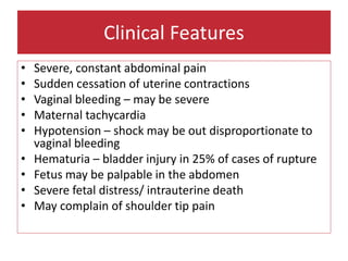 Uterine Rupture OSCE | PPTX