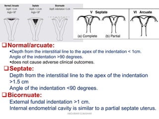 Uterine septum ASRM GUIDELINES2016 | PPSX