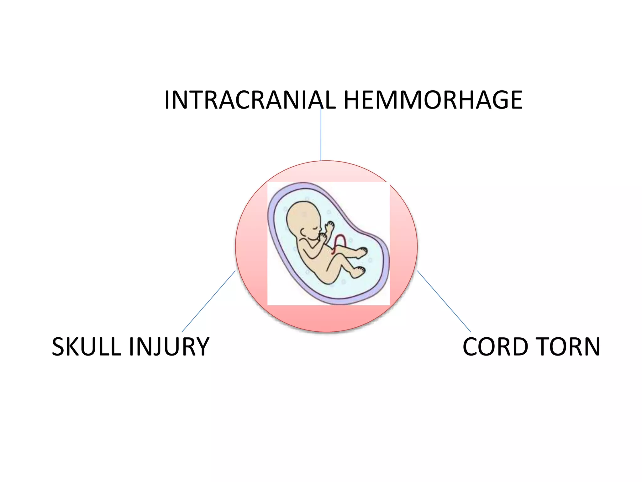 Uterine Inertia, Precipitate Labor and Uterine Tetany | PPTX